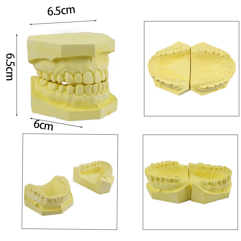 Dental Model Dentures Material Standard Gypsum Model Full-Port Super ...