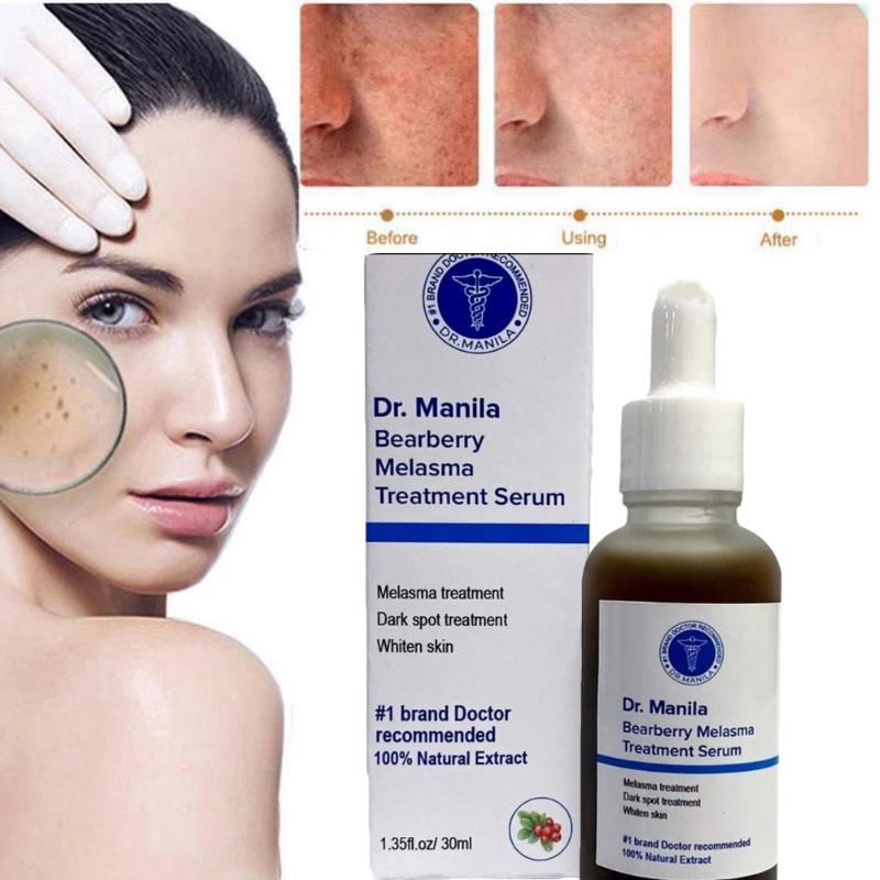 DR Manila Bearberry Melasma Treatment Serum ( No.1 Treatment For Melasma, Freckles )dr manila ...