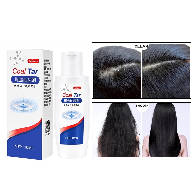 110ml Coal Tar Shampoo Anti-stripping Anti-dandruff Oil Control ...