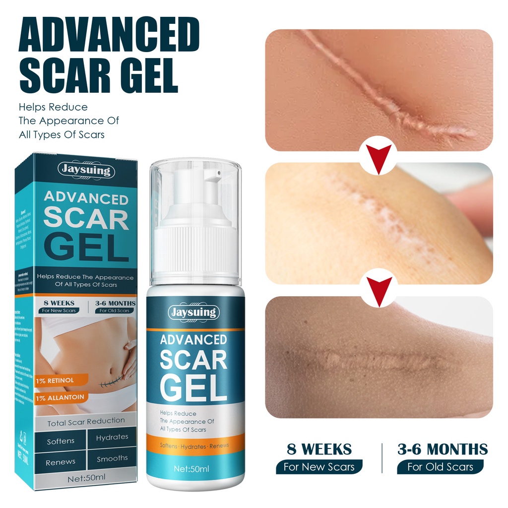 Scar repair cream Gel skin scars Cream after delivery, stretch hot scar ...