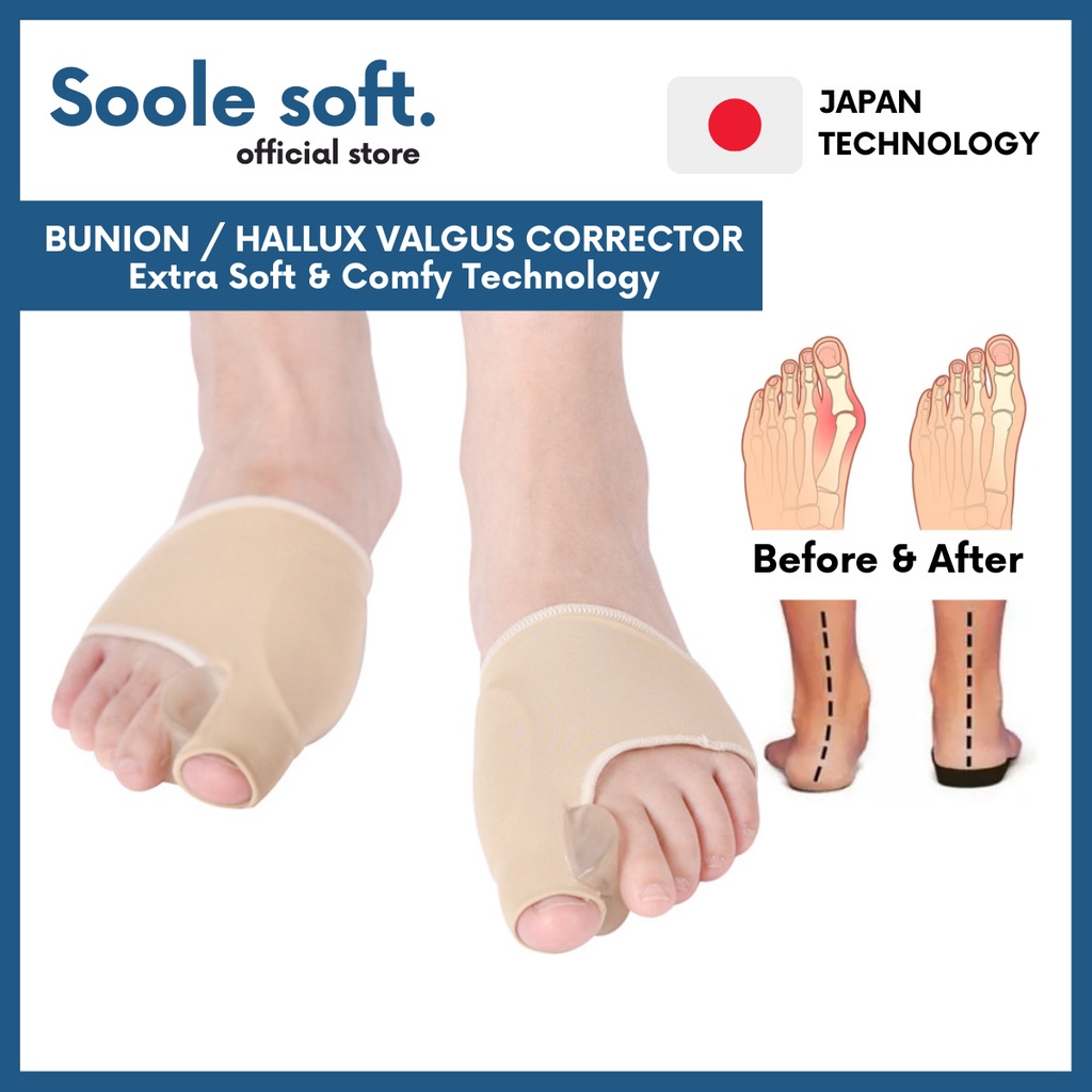 𝗦𝗼𝗼𝗹𝗲 𝘀𝗼𝗳𝘁. Japan Tech Bunion Corrector Hallux Valgus Gel Pad Sleeve ...