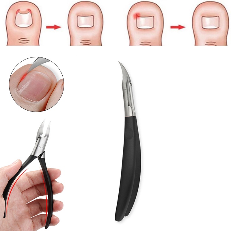 Nail Cutter Cuticle Nippers Profesional Ingrown Toenail Scissors Dead ...