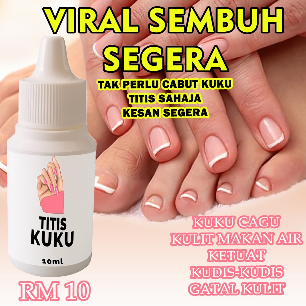 Penawar Kuku Rosak Cagu Anti Fungal Nail Repair Fungus Ubat Herbal Ubat ...