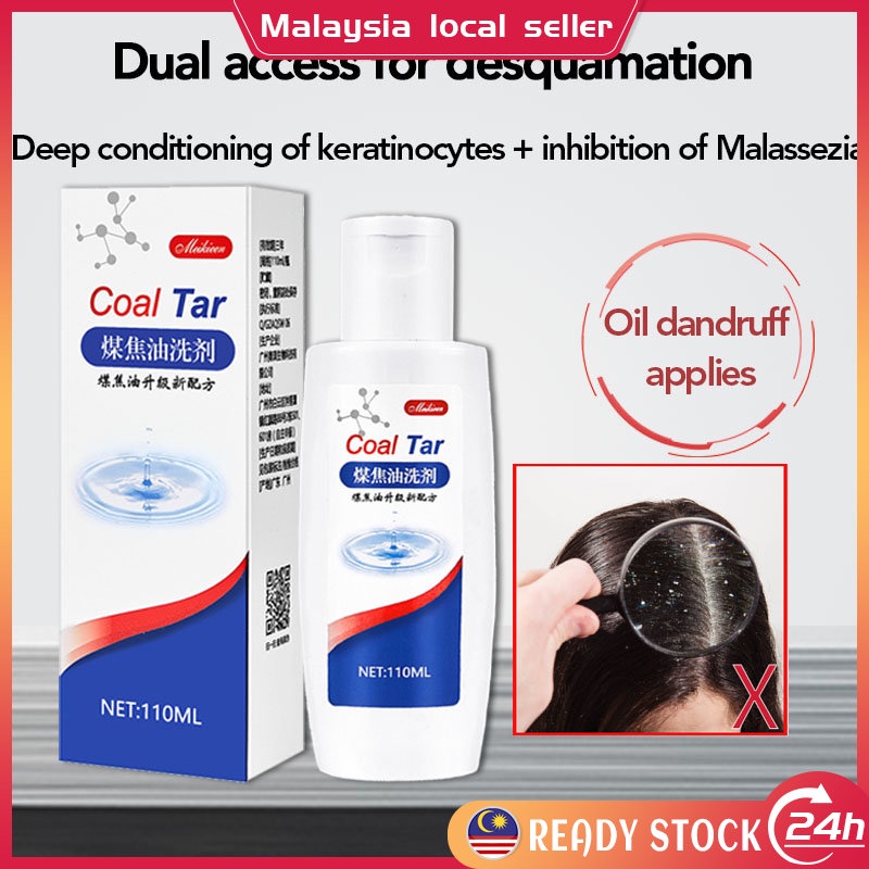 110ML Coal Tar Lotion Anti-dandruff Anti-itch Antibacterial Liquid ...