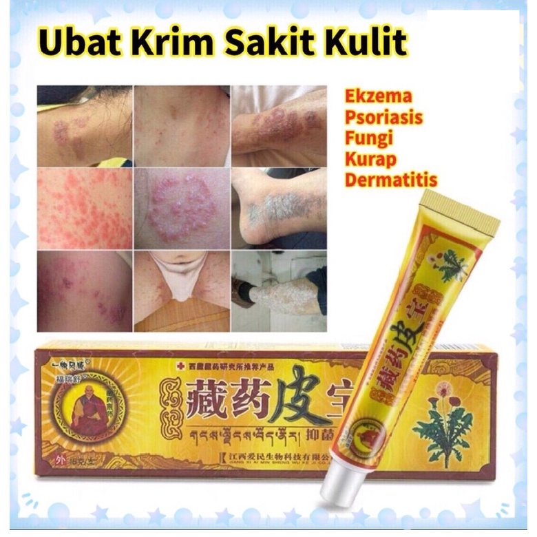 Eczema treatment Anti bacterial skin fungus cream Ubat kurap Ubat panau ...