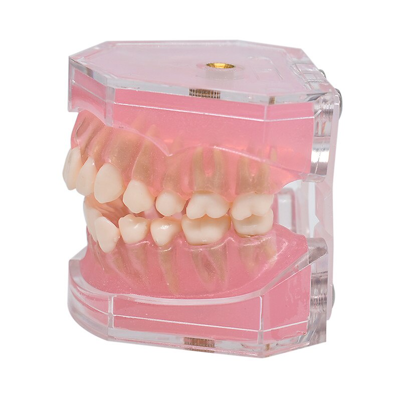 Dental Model Removable Teeth Soft Gum Teeth Model TYPODONT Tooth Model ...