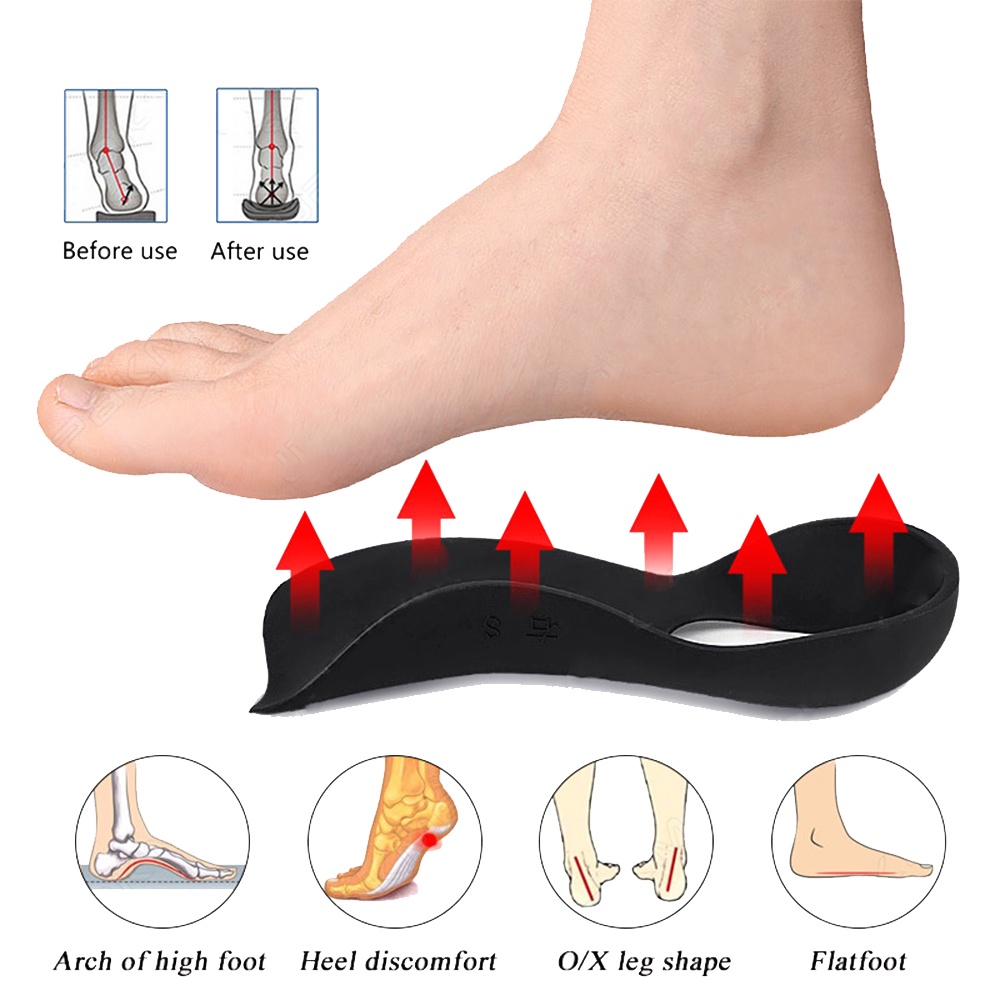 XO leg-shaped corrective insole inverted and everted eight-character ...