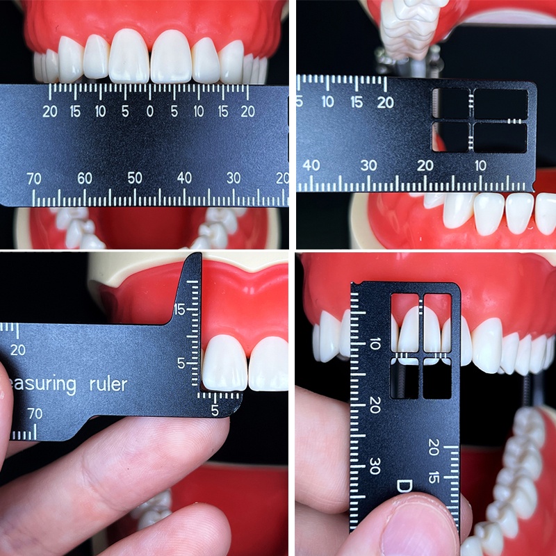 Aluminum Dental Precision Measuring Ruler For Photography And Dentistry ...