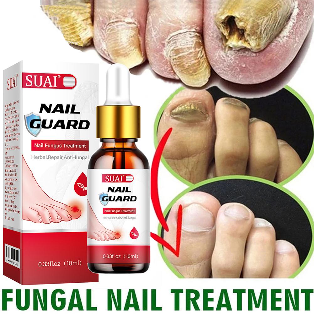 Suai Nail Fungus Treatment Serum Toe Fungal Repair Products Hand Foot