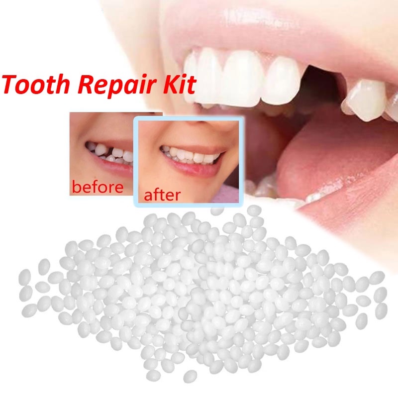 Temporary Resin Tooth Repair Shapeable Falseteeth Gaps Filling Solid ...