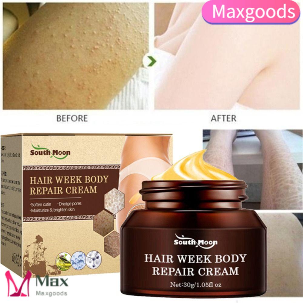 Max Keratosis Pilaris Repair Treatment Cream 30g Removal Chicken Skin