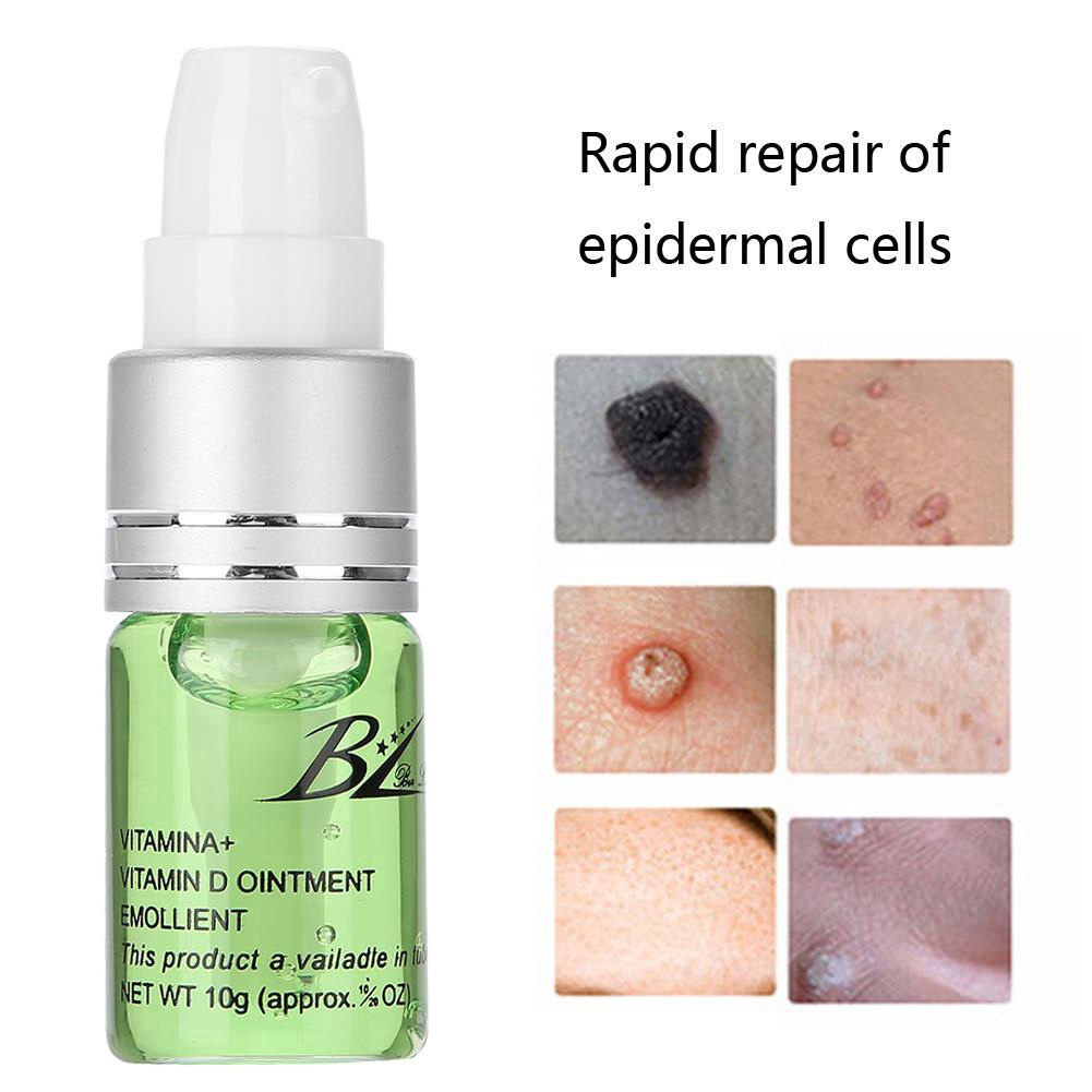 Painless Mole Skin Dark Spot Removal Face Wart Tag Freckle Removal ...