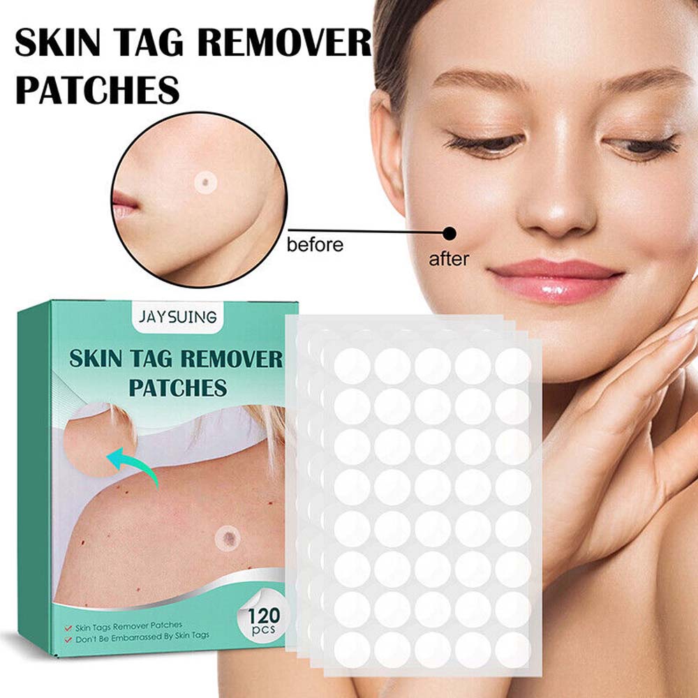 120pcs/Box Warts Remover Patch Skin Tags Pimple Treatments Cream ...