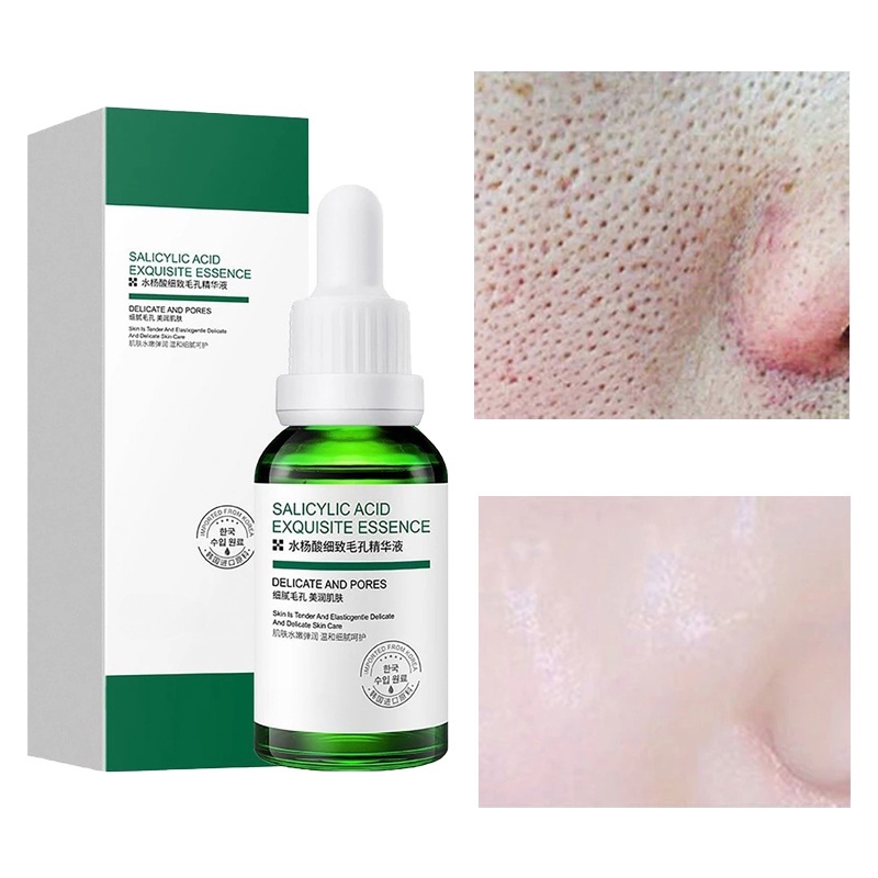 Salicylic Acid Pore Refining Serum Moisturizing Nourishing Firming ...