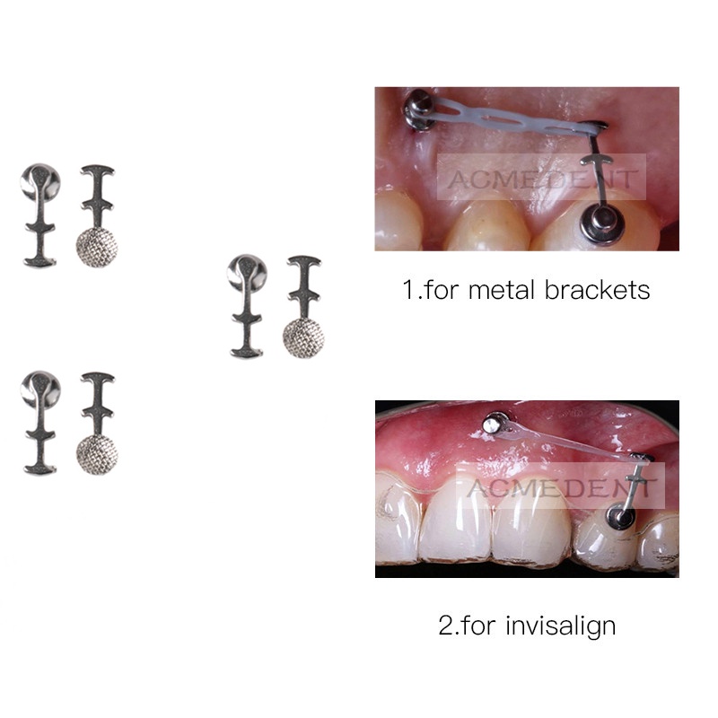 30Pcs/Lot Dental Lingual Buttons Double-Sided Hooks Crimpable Multi ...