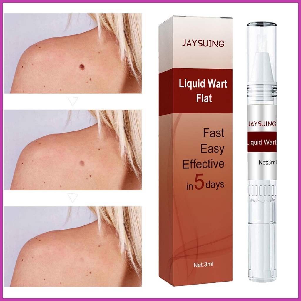 Skin Tag Remover Wipe Off Tags & Moles Remover Natural Non-Irritating ...