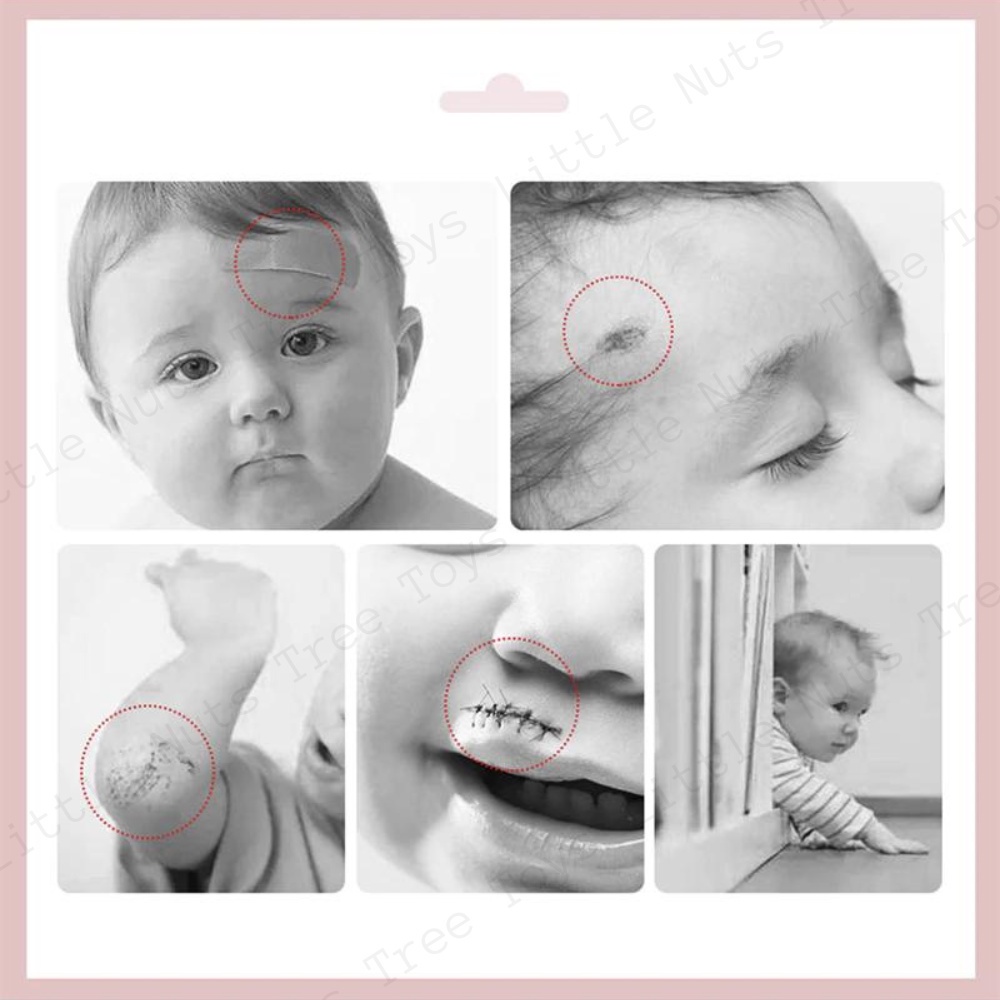 Edge & Corner Guards/Baby Bumper/Edge Strip/L-Shape/U-Shape/kids ...