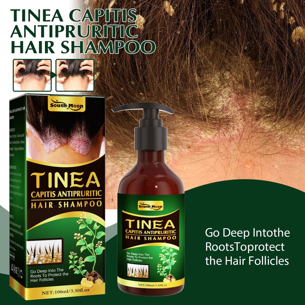 Refreshing Maintenance Scalp Shampoo Tinea Capitis Shampoo Anti-mite ...