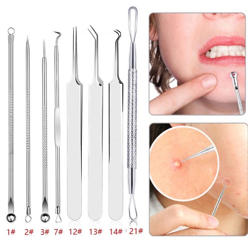 Pimple Kit Set Stainless Steel Pimple Tools Extractor Needle Blackhead ...