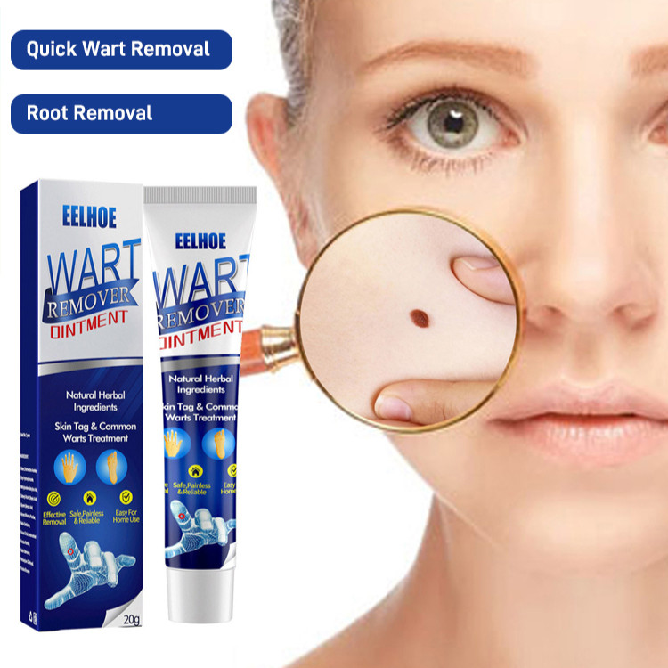 Waterproof body wart removal cream plant extract flat warts | Shopee ...