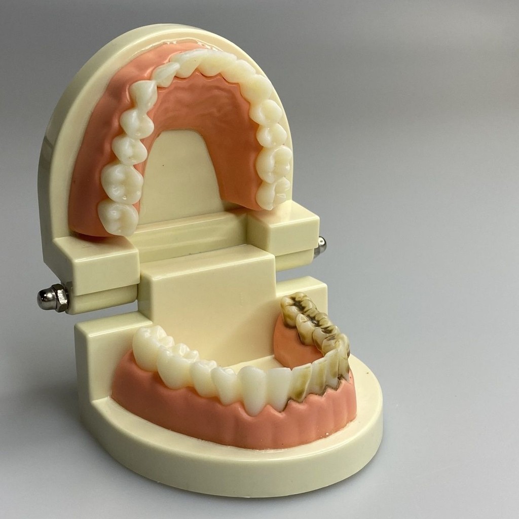 Yixi Oral Tooth Model Simulation Fake Half Tooth Cavity Props Dental ...