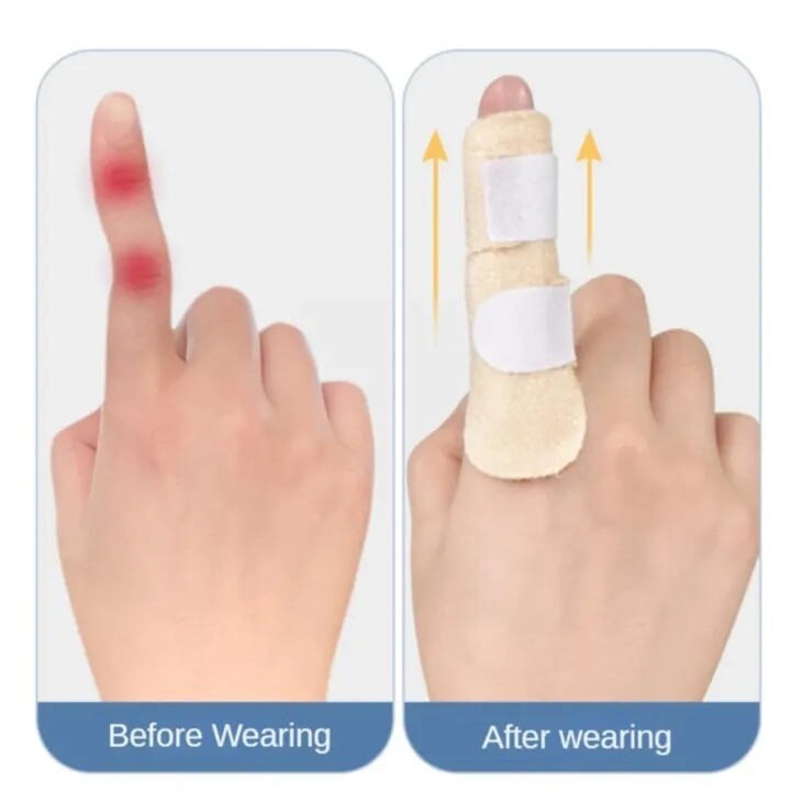 Adjustable Fixing Finger Splint Set for Arthritis and Ligament Pain ...