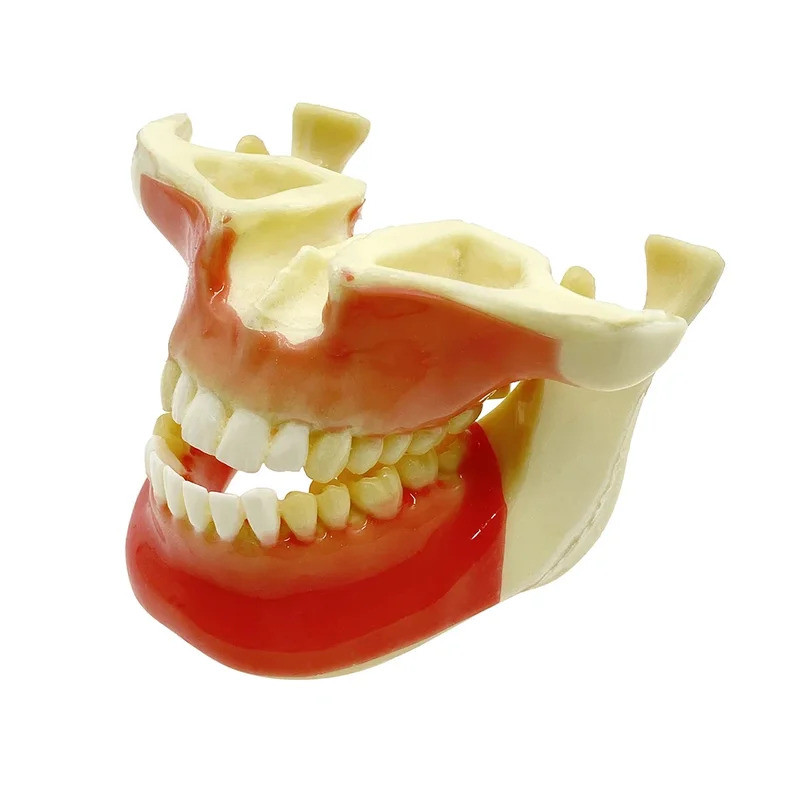 Dental Ortho Practice teeth model Teaching demonstration model for ...