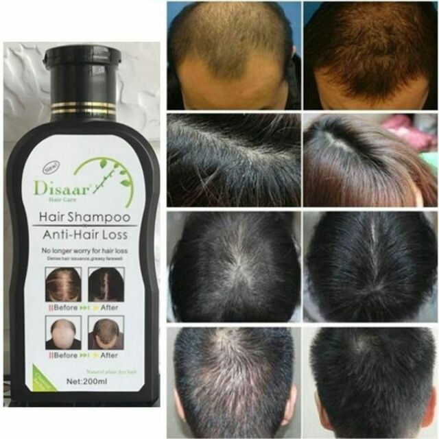 DISAAR HAIR SHAMPOO (200 ml) + Hair Essential Oil Anti Hair Loss ( 30 ...