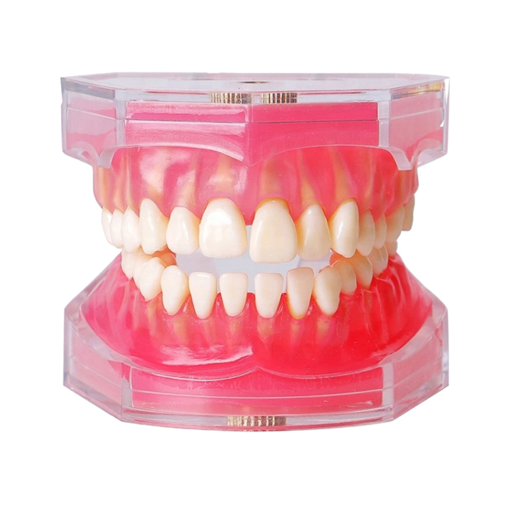 Dental Model Removable Soft Gum Tooth Model Adult Standard Dental ...