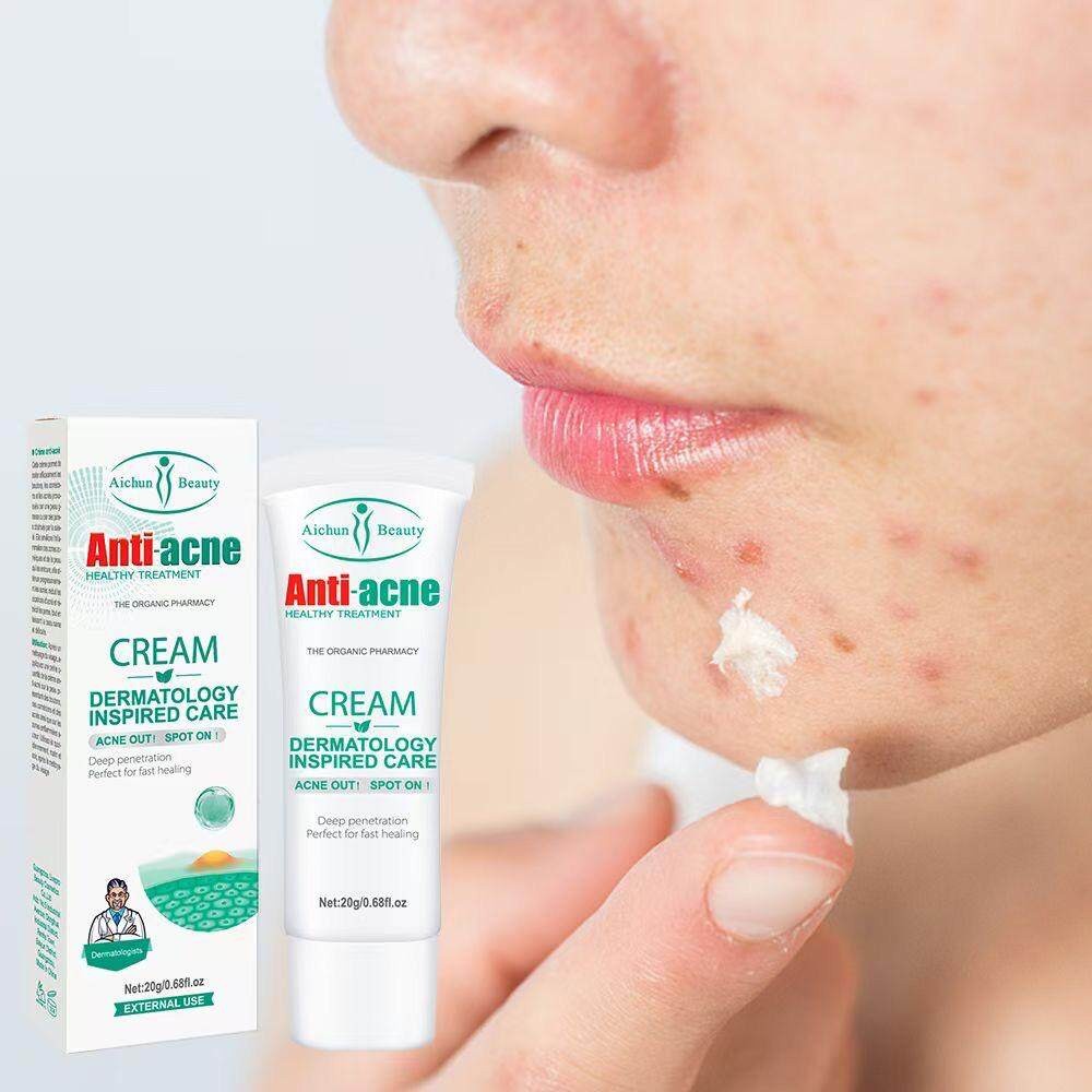 Aichun Beauty Anti-Acne & Pimples Removal Cream – Visible Results ...