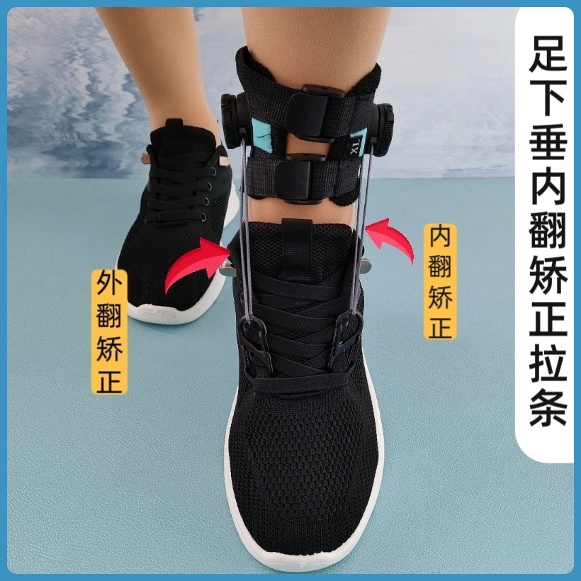 Foot Valgus Correction Deviation Paralyzed Foot Valgus Valgus ...