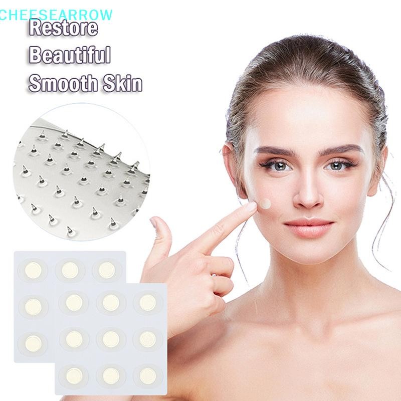 CheeseArrow 9 Stickers Microneedles Anti Acne Pimple Removal Soothing ...