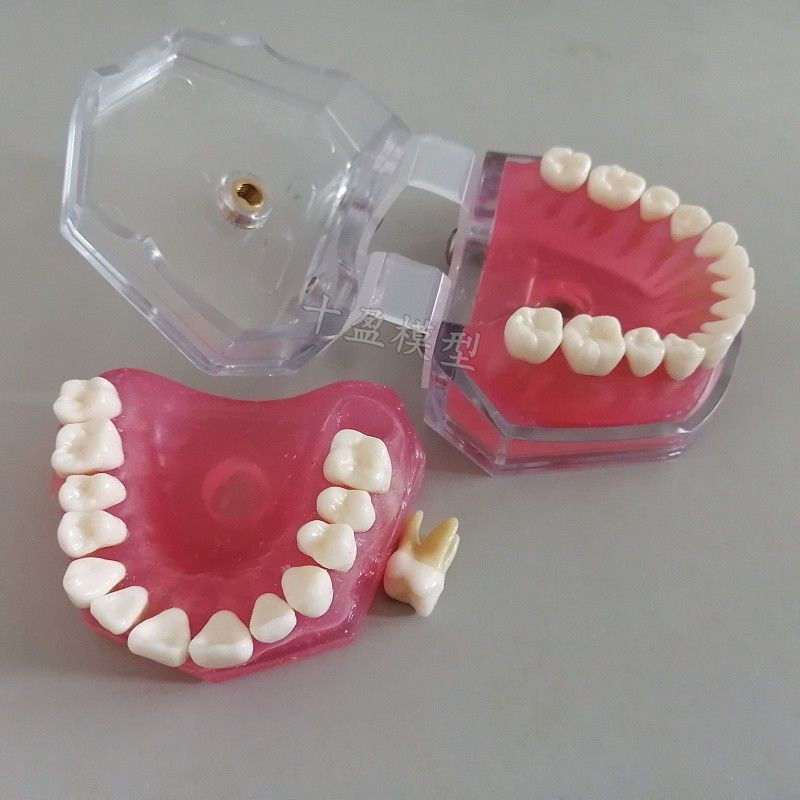 Yixi Dental Model Oral Science Teaching Model Practice Tooth Extraction ...