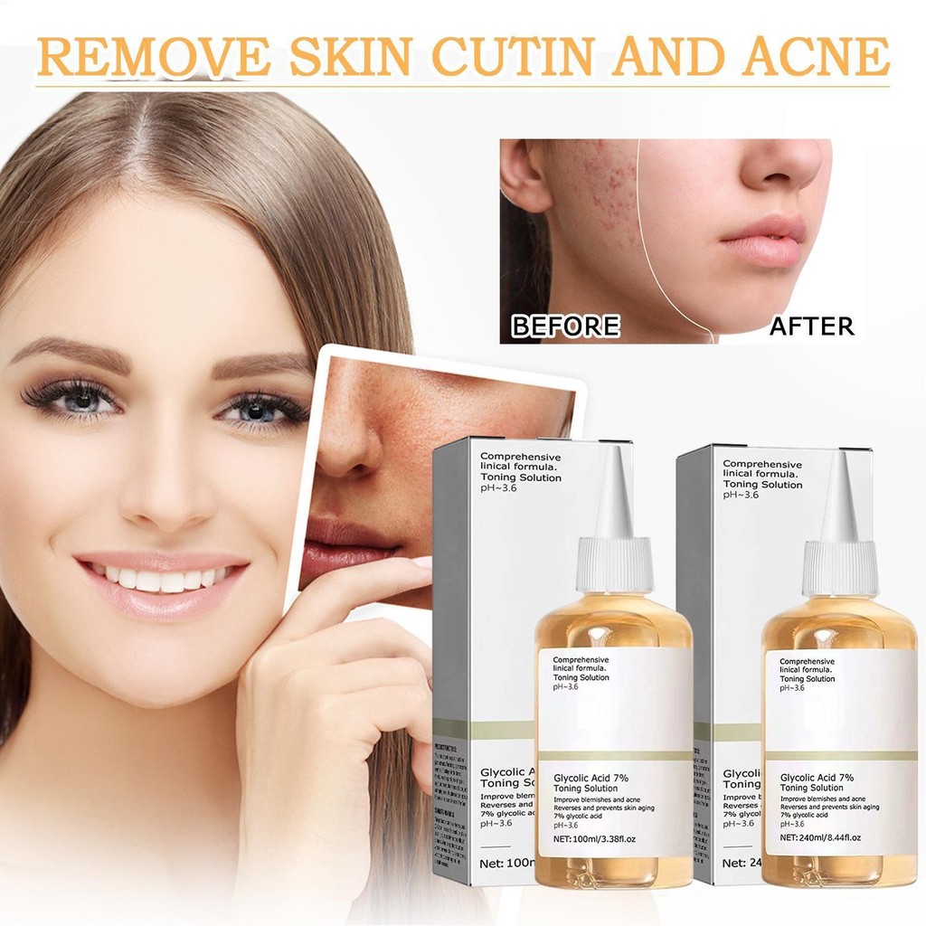 Glycolic Acid 7% Toning Liquid Face Toner Nourishing Toner Skin ...