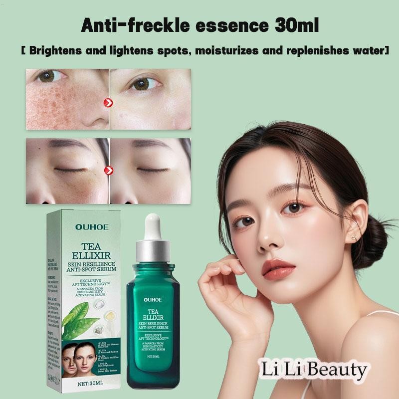 Anti-freckle essence 30ml Skin Brightening Essence Black Spot Remover ...