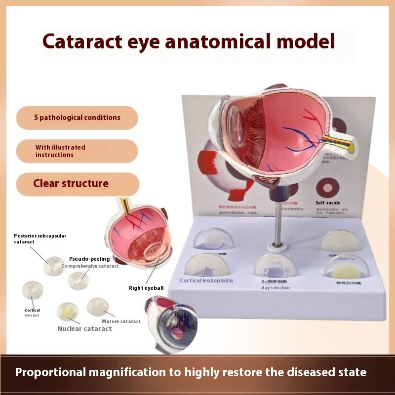 Cornea Eyeball Model Human Eye Model Human Eye Demonstration Teaching ...