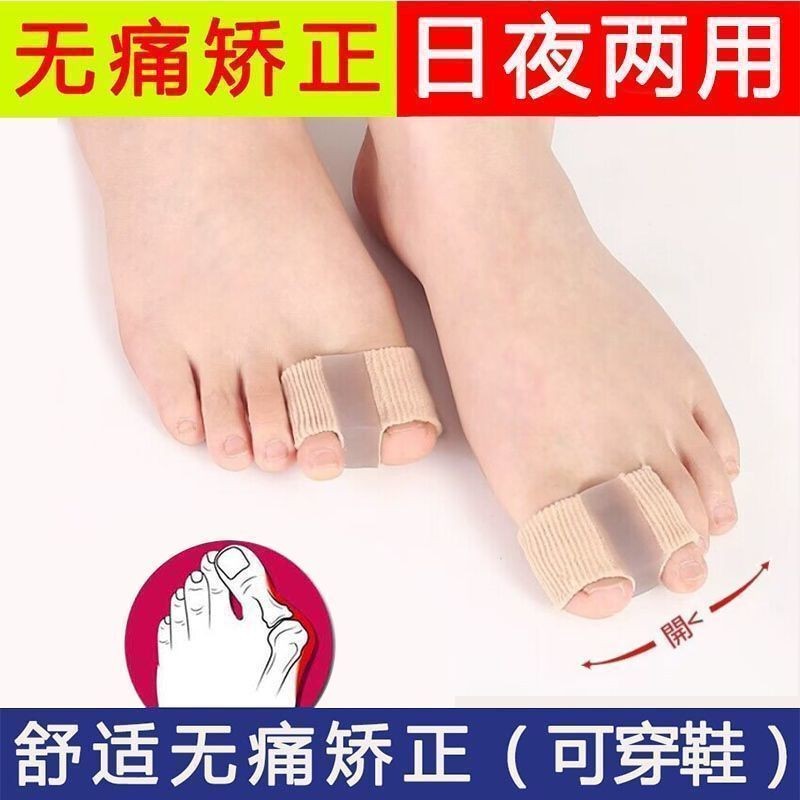 Deformed Bones Medical Toe Corrector Thumb Overlapping Foot Bone Valgus ...