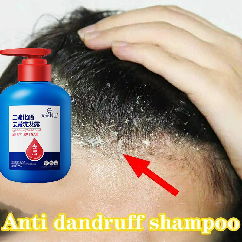 Anti dandruff and anti itch shampoo 300ml inhibits dandruff moisturizes ...