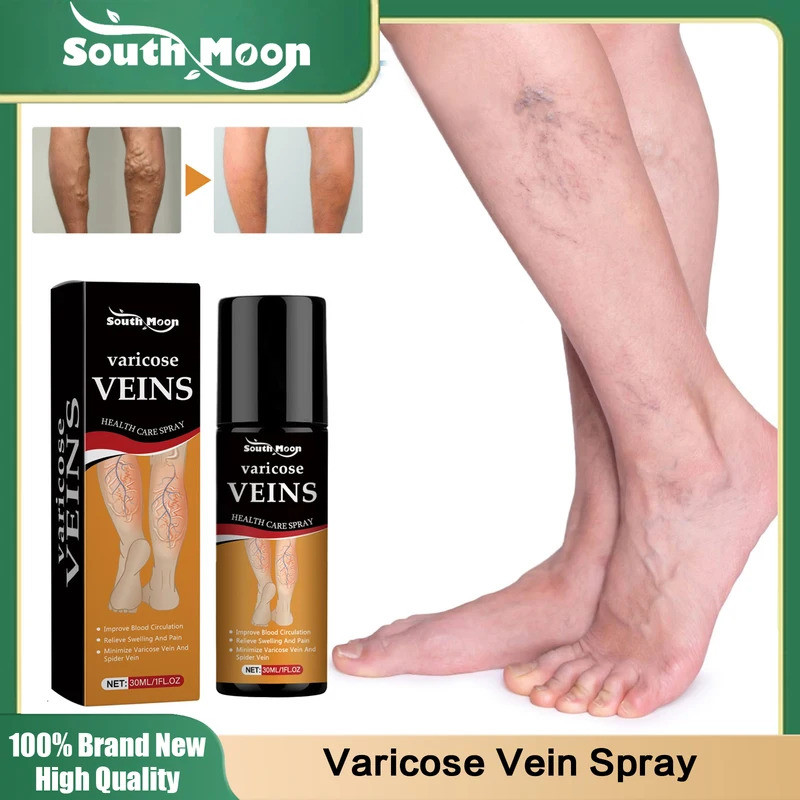 Fast shippingVaricose Vein Spray Vasculitis Phlebitis Earthworm Legs ...