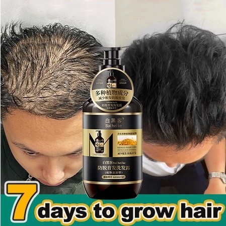Anti-Hair Loss Shampoo 400ml Hair Growth Shampoo Ginseng He Shou Wu Shampoo Nourishes the scalp ...