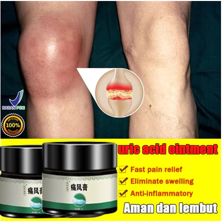 Finger Red Swelling Joint External Use Cream Pain Swelling Big Toe Pain ...