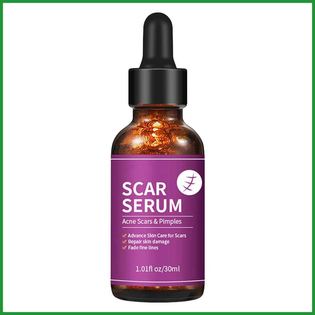 Oil for Scars 30ml Scar Care Scar Remover Skincare Body Oil for Scar ...