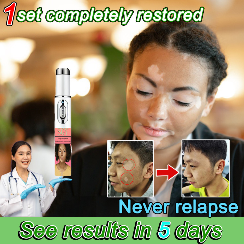vitiligo treatment cream original Vitiligo laser pen, vitiligo remover ...