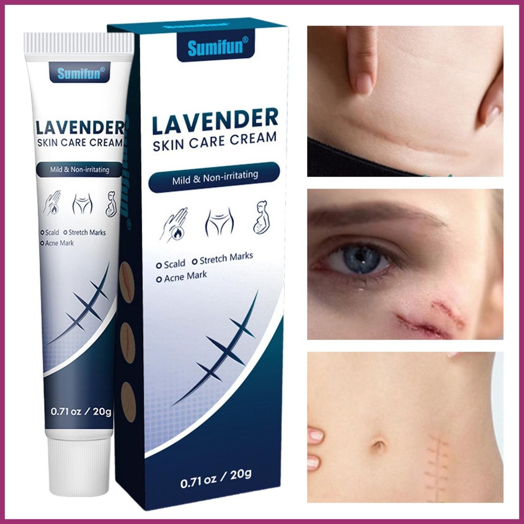 Scar Removal Cream for Old Scars Lavender Scar Cream Stretch Mark ...