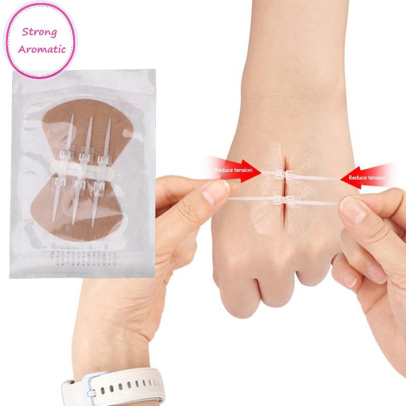 STRO Zipper Band-aid Painless Wound Closure Device Suture-free Wound ...