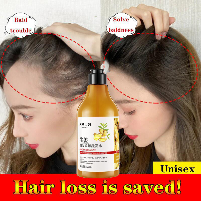 Ginger Hair Regrowth Dense Fast Anti Hair Loss Repair Damaged Hair ...
