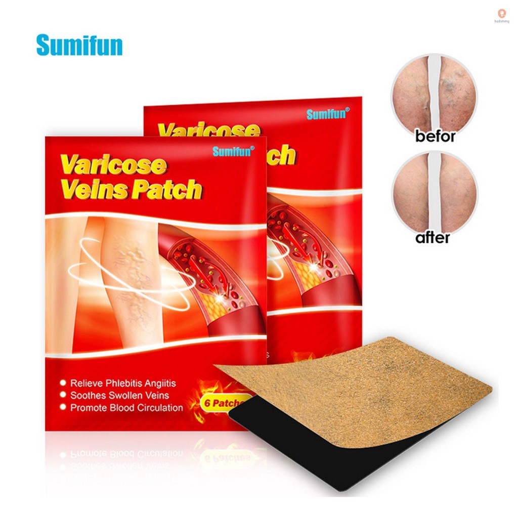 Vein ointment patch Vein curvature posting ointment patch for external use on legs Top2 Patch ...