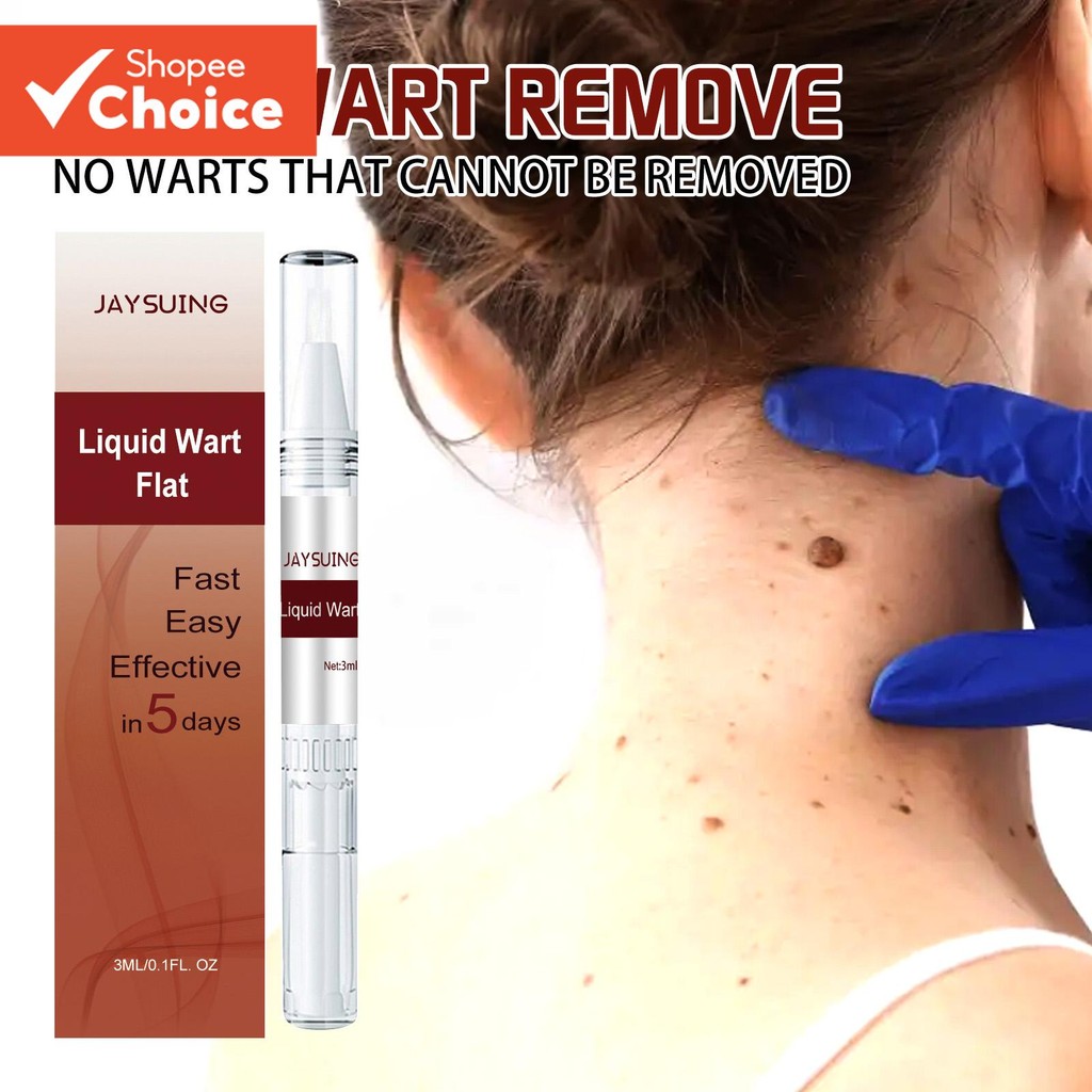 Removing Against Moles Liquid Pen Skin Tags Remover Against Papillomas ...