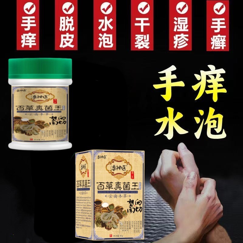 [Antibacterial Anti-itch] Sweat Herpes Hand Blisters Itchy Hands Peeling Dry Cracking Blistering ...
