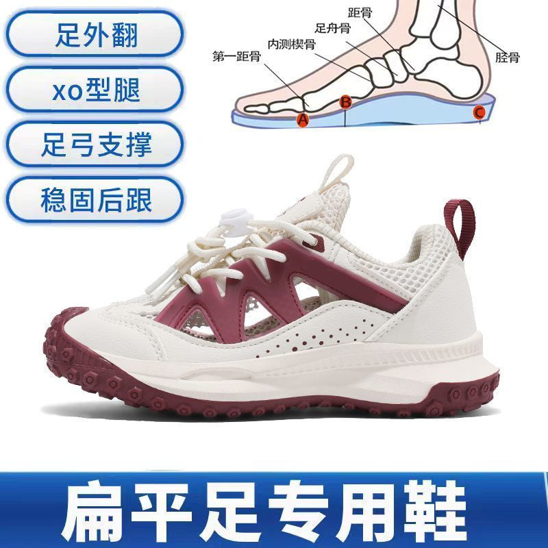 Arch Support High Arch X O-Shaped Legs Eight-Shaped Foot Shoes Arch ...